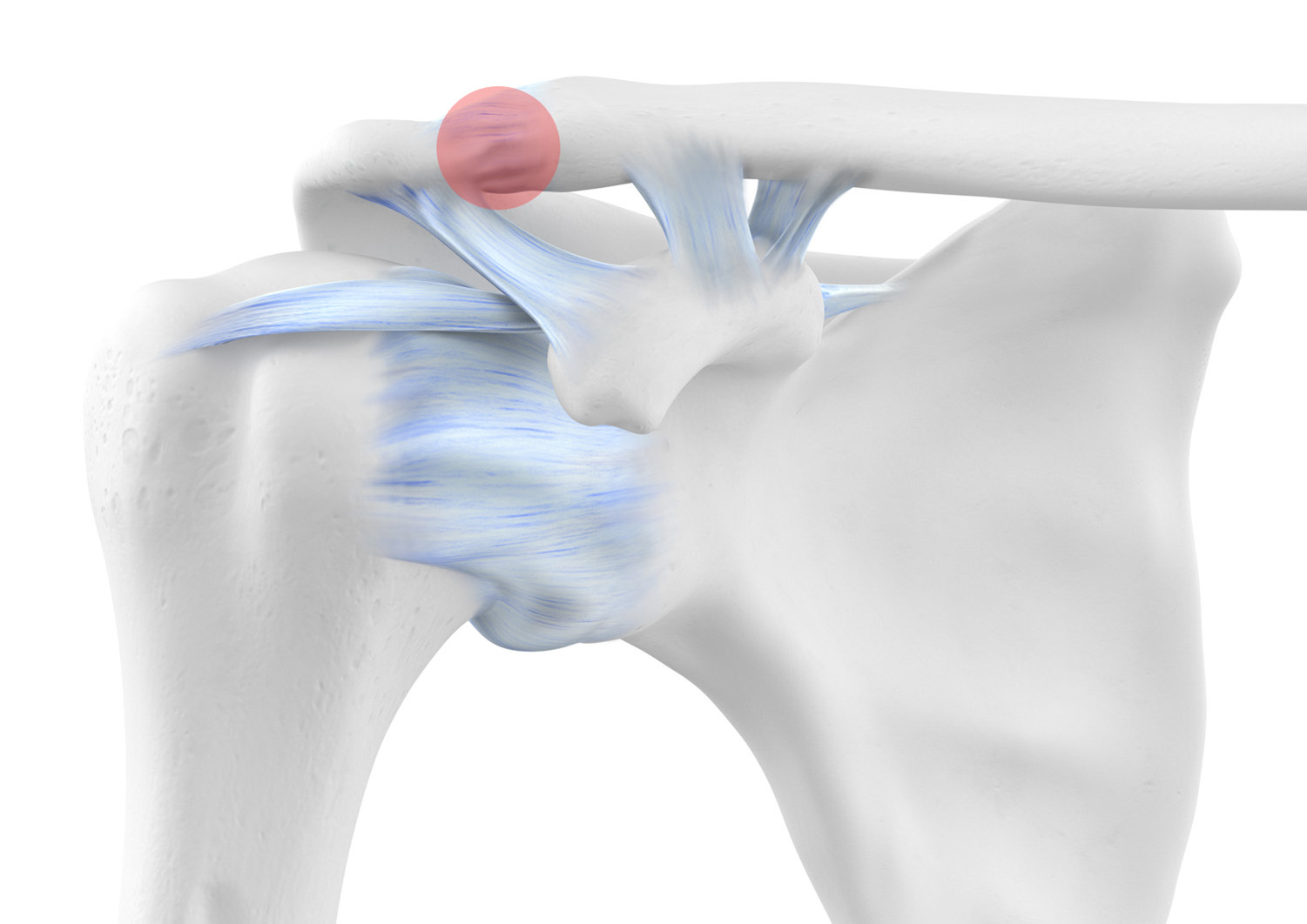 AC-GELENKSARTHROSE - SPORTORTHO IHR KOMPETENZZENTRUM FÜR KNIE ...